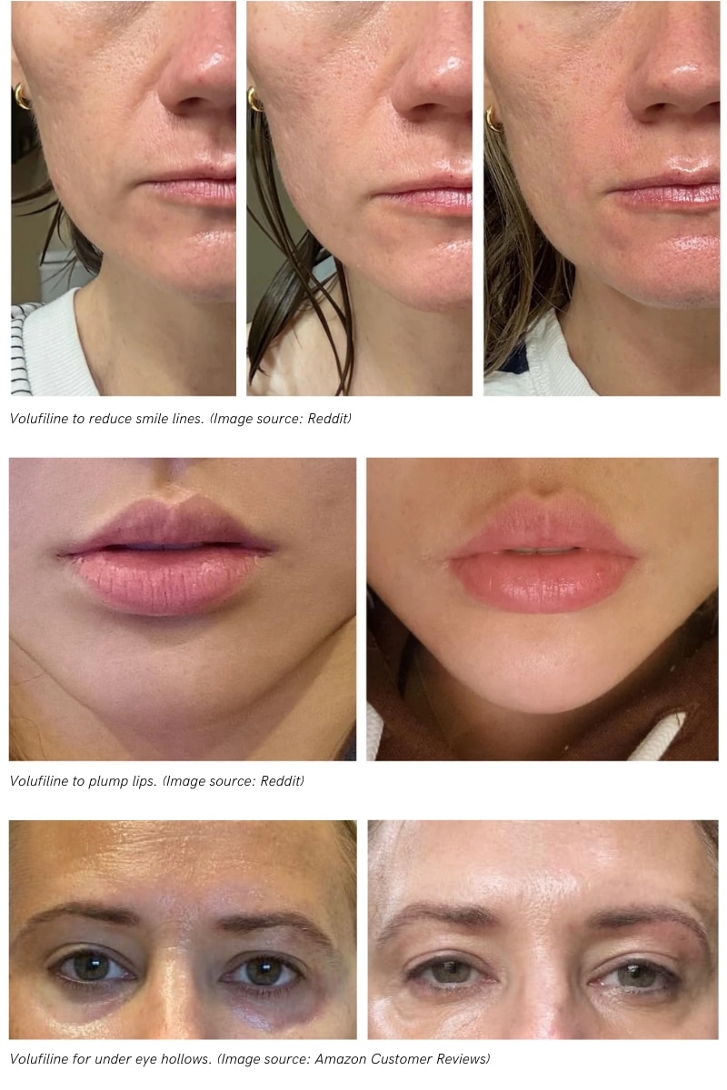 Volufiline: The Filler-Free Solution for Naturally Plumper Skin